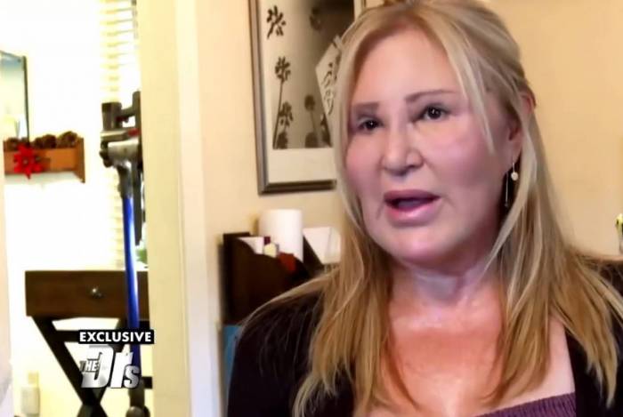 Ex-modelo fica cega e com o rosto deformado após preenchimento facial ...