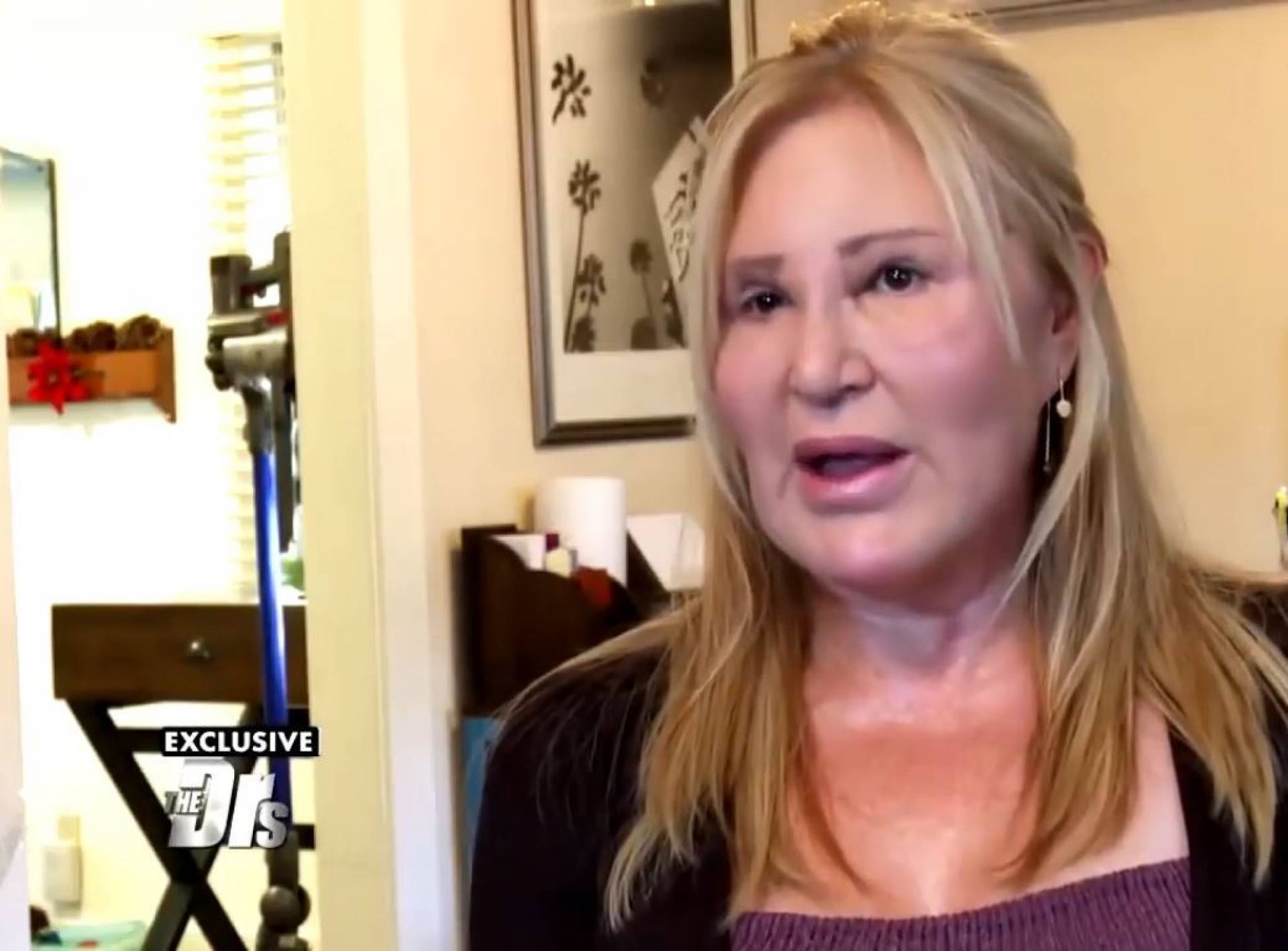 Ex-modelo fica cega e com o rosto deformado após preenchimento facial ...