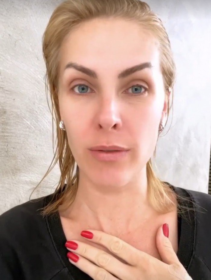 Ana Hickmann Sofre Acidente Doméstico Cena Mais Assustadora Que Já Vi
